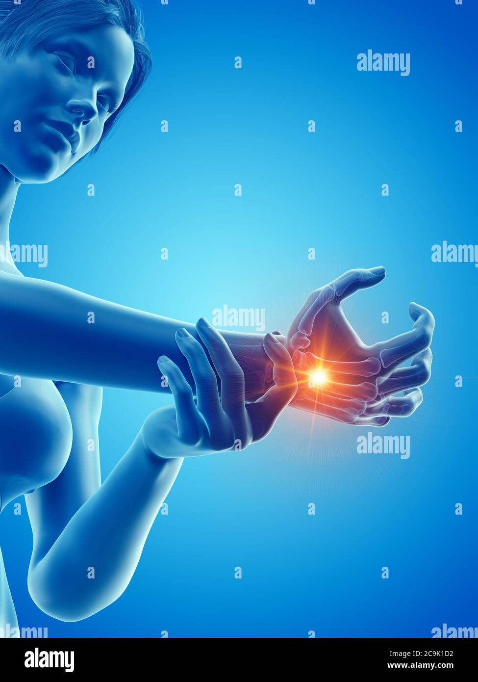 Woman with a painful hand, illustration Stock Photo - Alamy