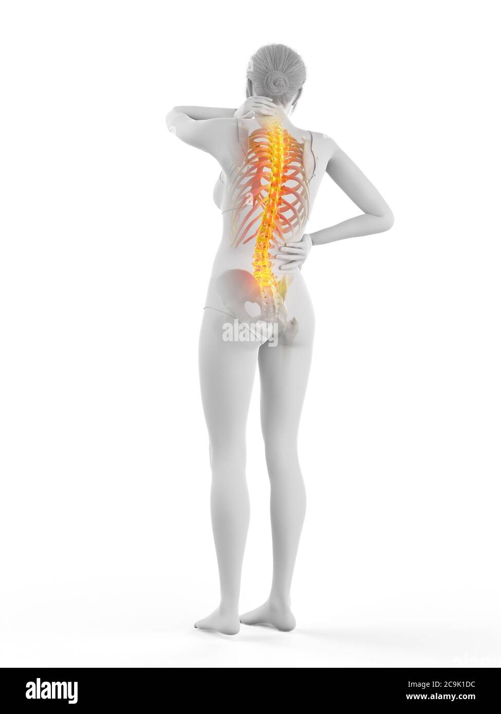 Woman with backache, illustration Stock Photo - Alamy