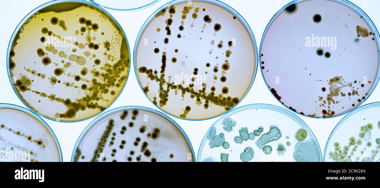 Bacterial colonies on agar plates Stock Photo - Alamy