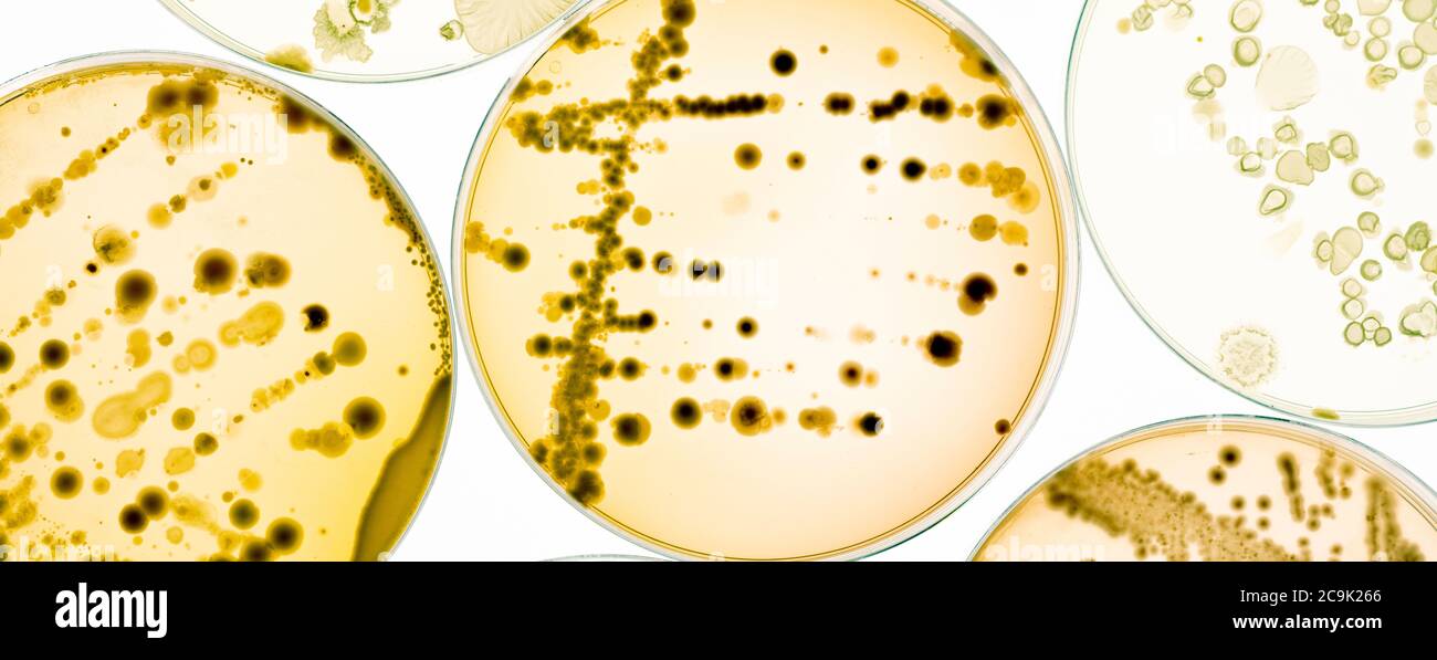 Bacterial colonies on agar plates Stock Photo - Alamy