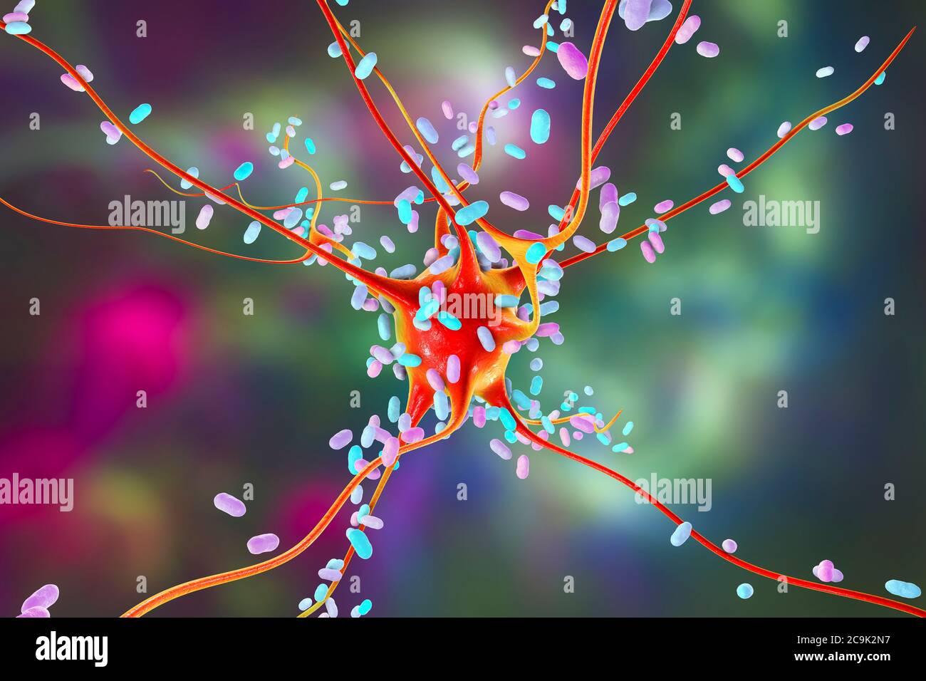 Bacterial encephalitis. Conceptual computer illustration showing ...