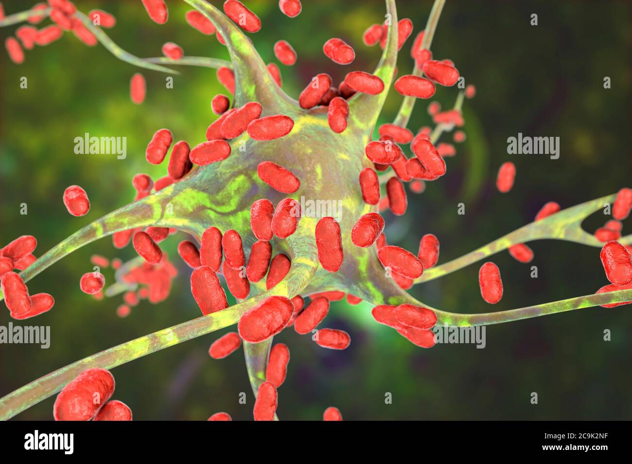 Bacterial encephalitis. Conceptual computer illustration showing ...