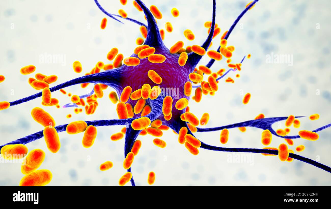 Bacterial encephalitis. Conceptual computer illustration showing ...