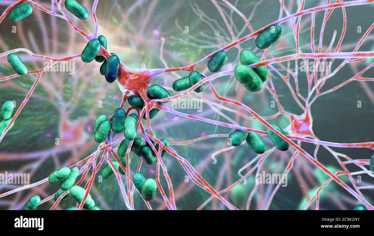 Bacterial encephalitis. Conceptual computer illustration showing ...