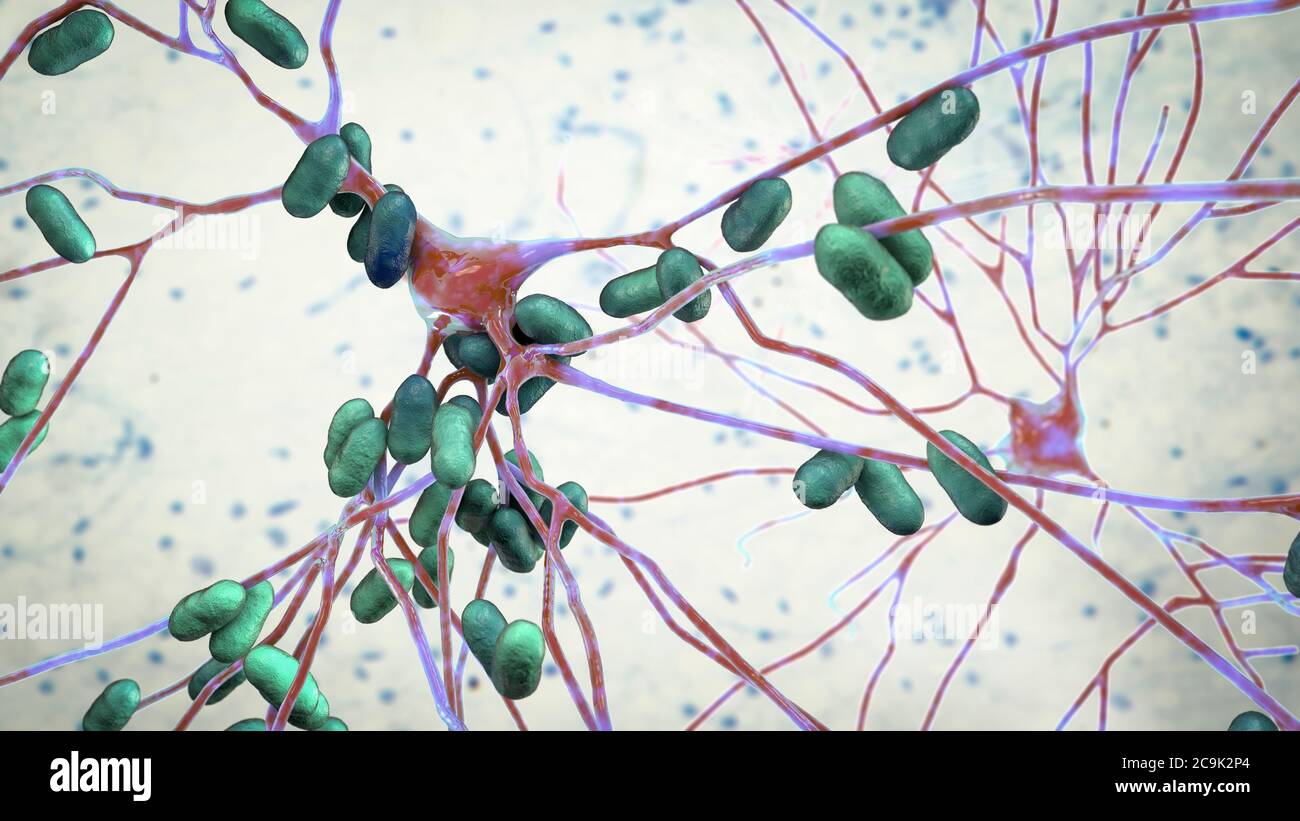 Bacterial encephalitis. Conceptual computer illustration showing ...