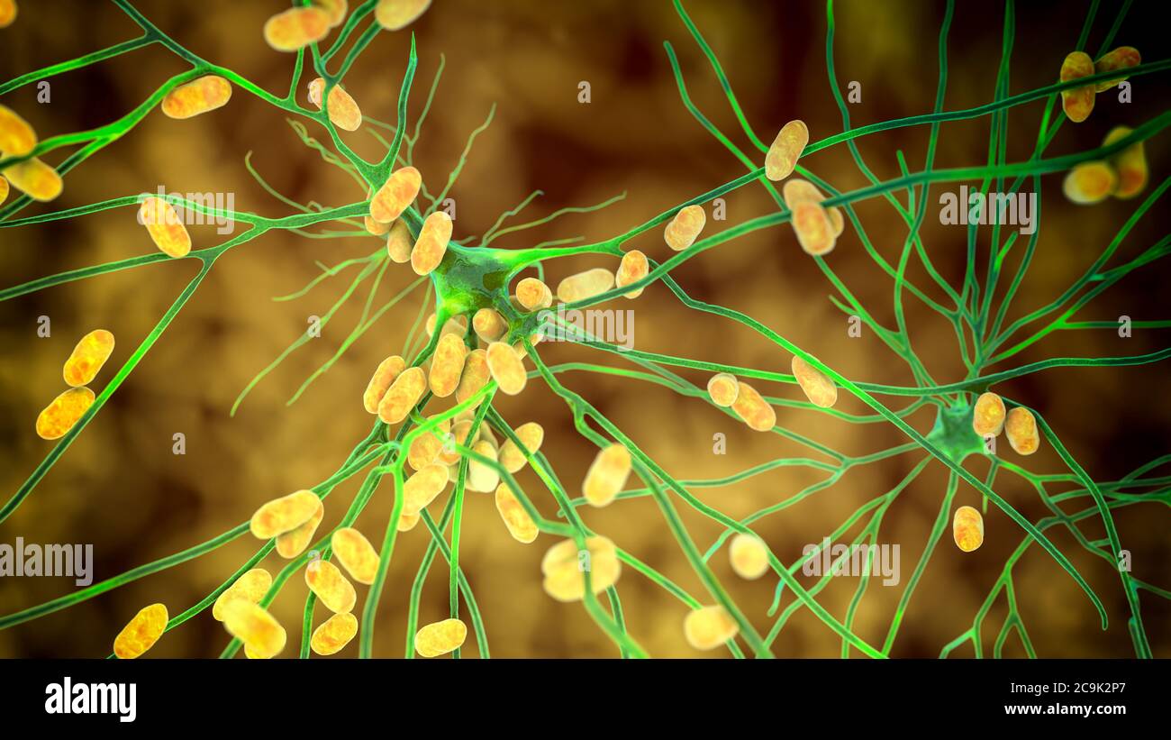 Bacterial encephalitis. Conceptual computer illustration showing ...
