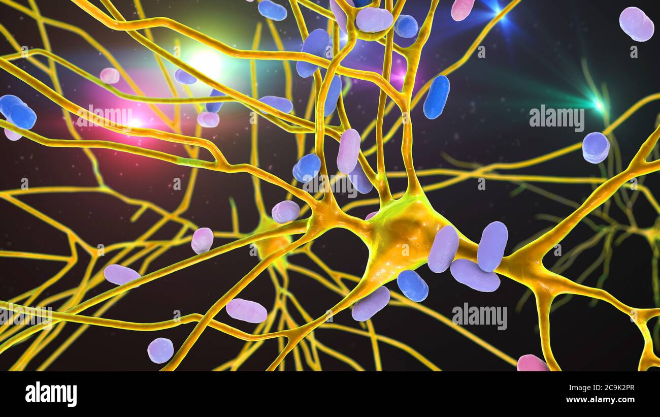 Bacterial encephalitis. Conceptual computer illustration showing ...