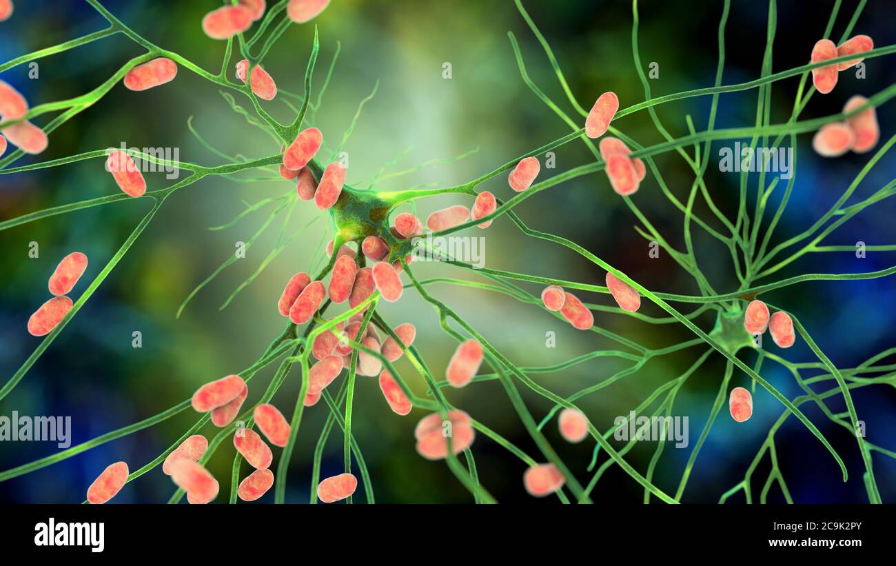Bacterial encephalitis. Conceptual computer illustration showing ...