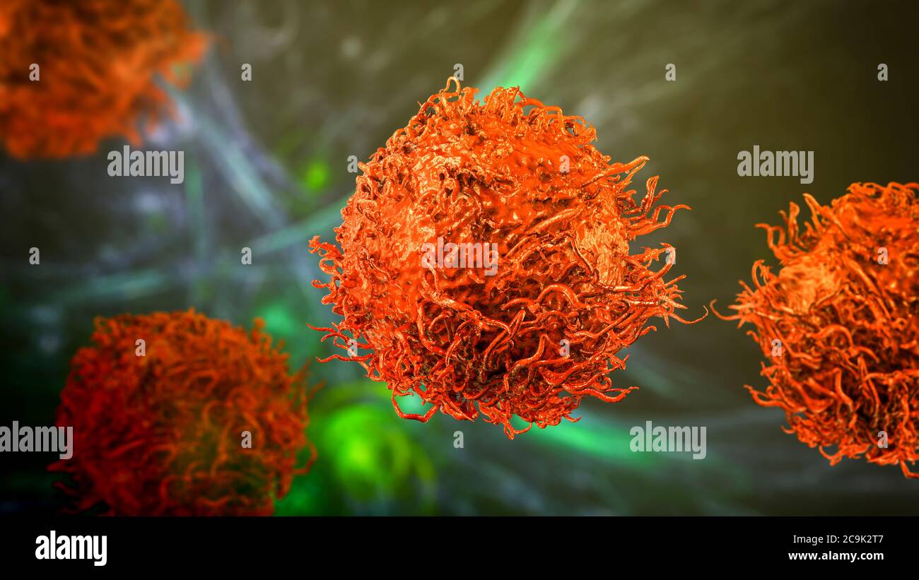 Stomach cancer cell, computer illustration Stock Photo - Alamy