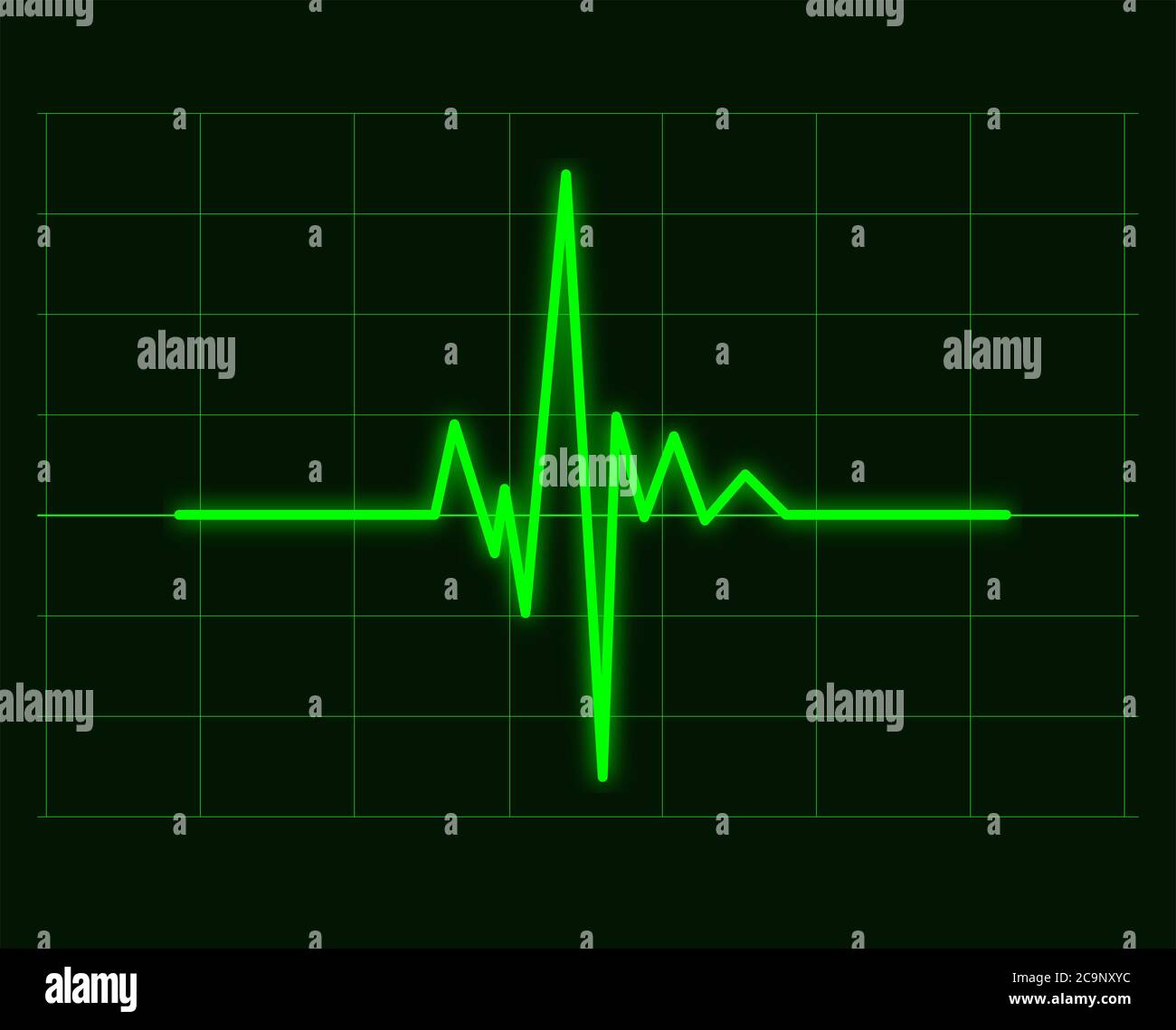 Vector illustration of green cardiac waveforms graph of heart ...
