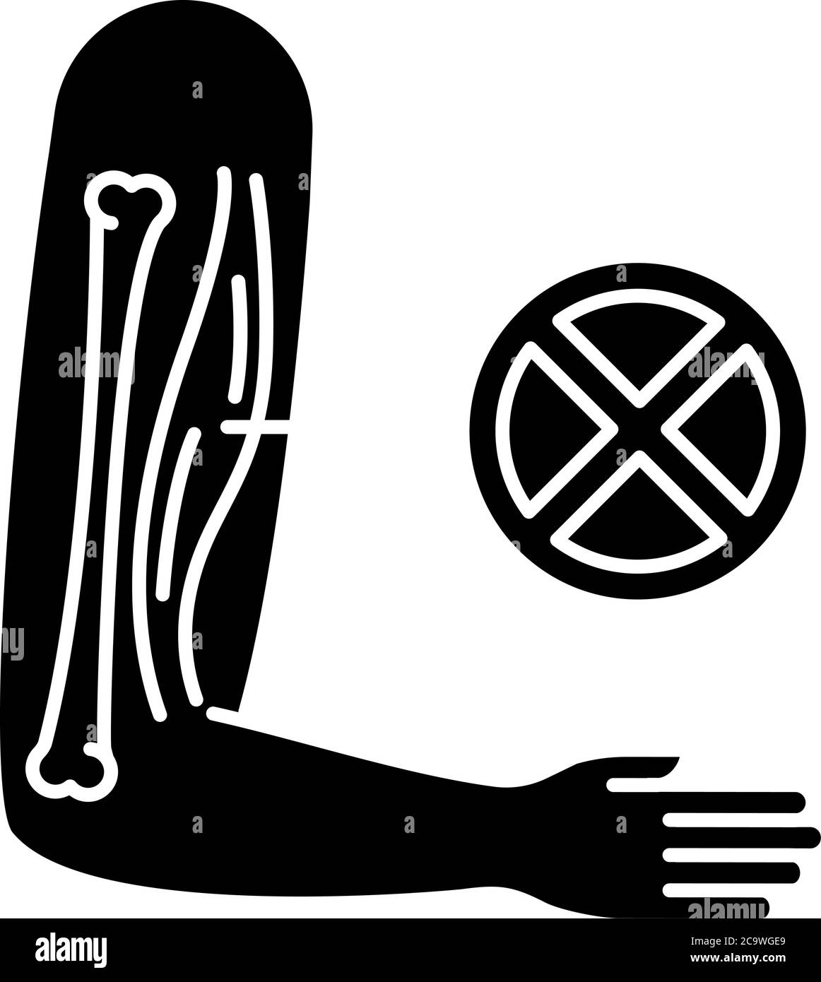 Muscular dystrophy black glyph icon. Chronic genetic disorder. Tissue ...