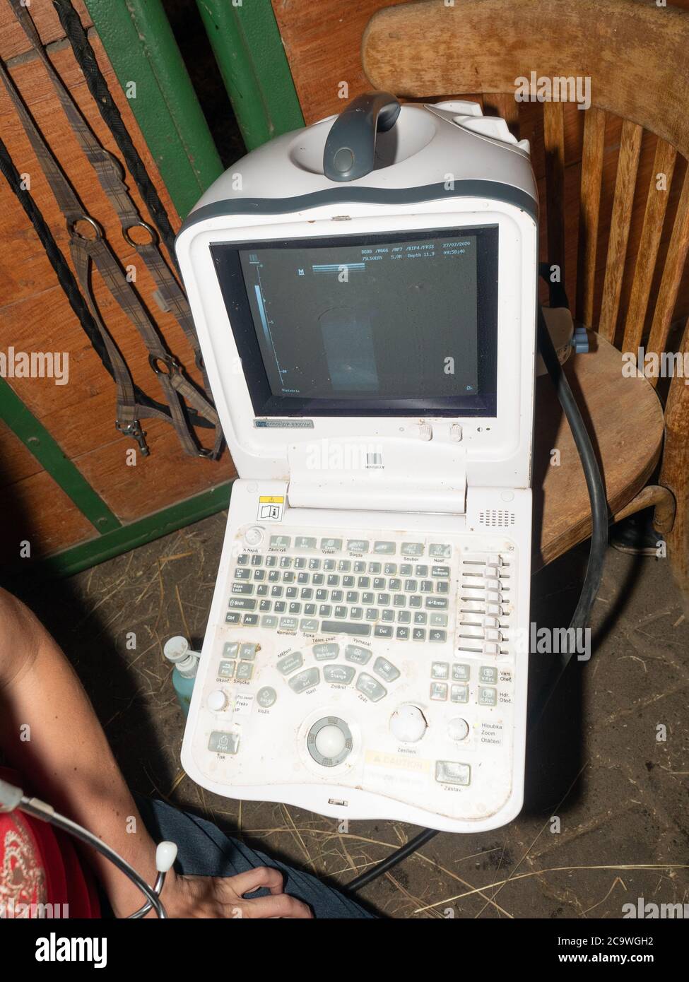 Doppler ultrasound device hi-res stock photography and images - Alamy