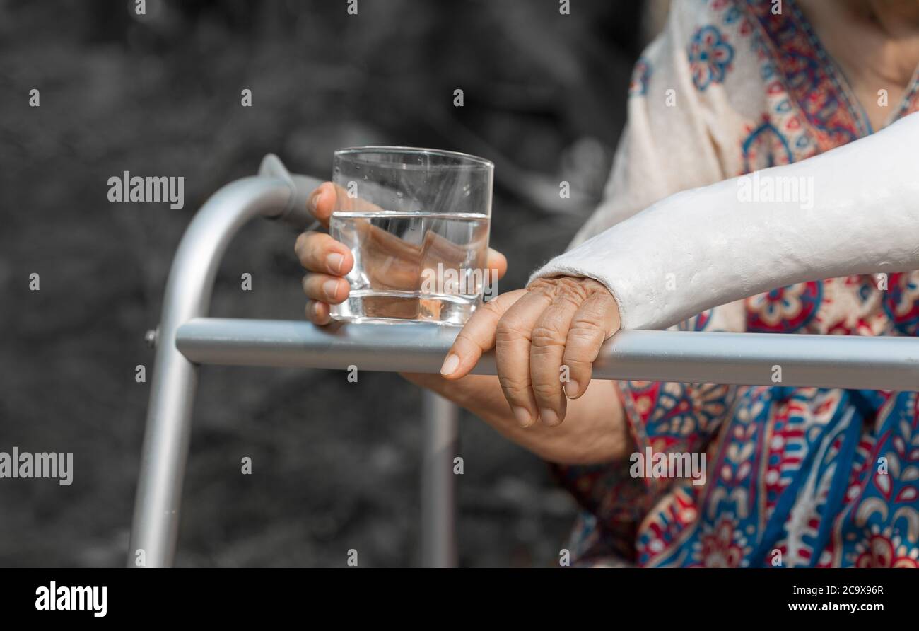 Broken wrist hi-res stock photography and images - Alamy