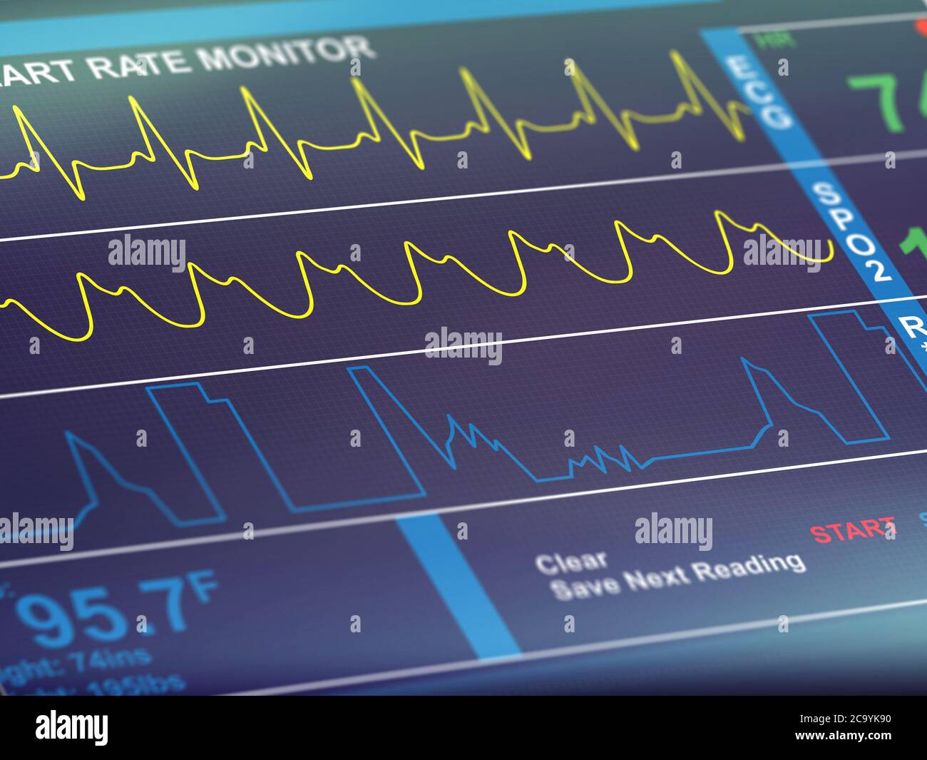 Cardiac frequency diagram Stock Photo - Alamy