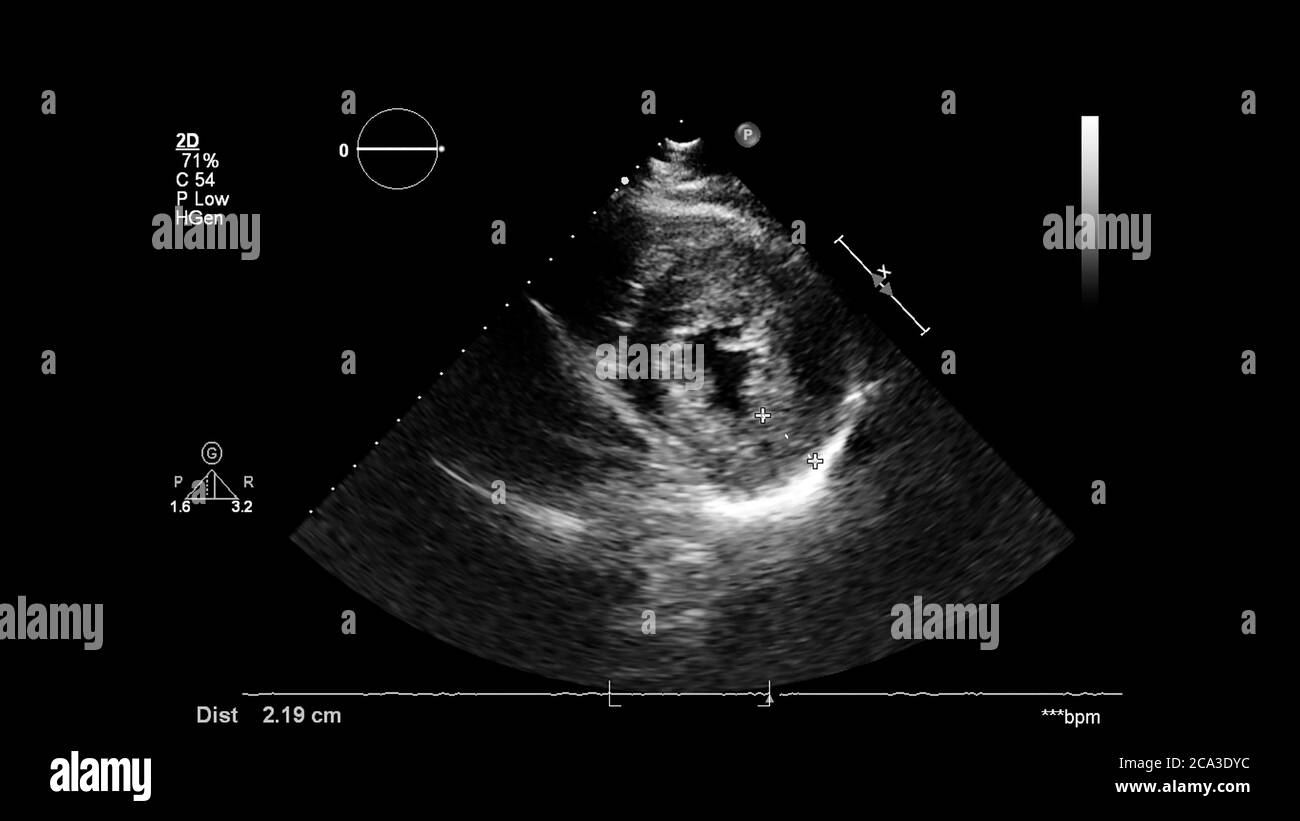 Cavity structure effect Black and White Stock Photos & Images - Alamy