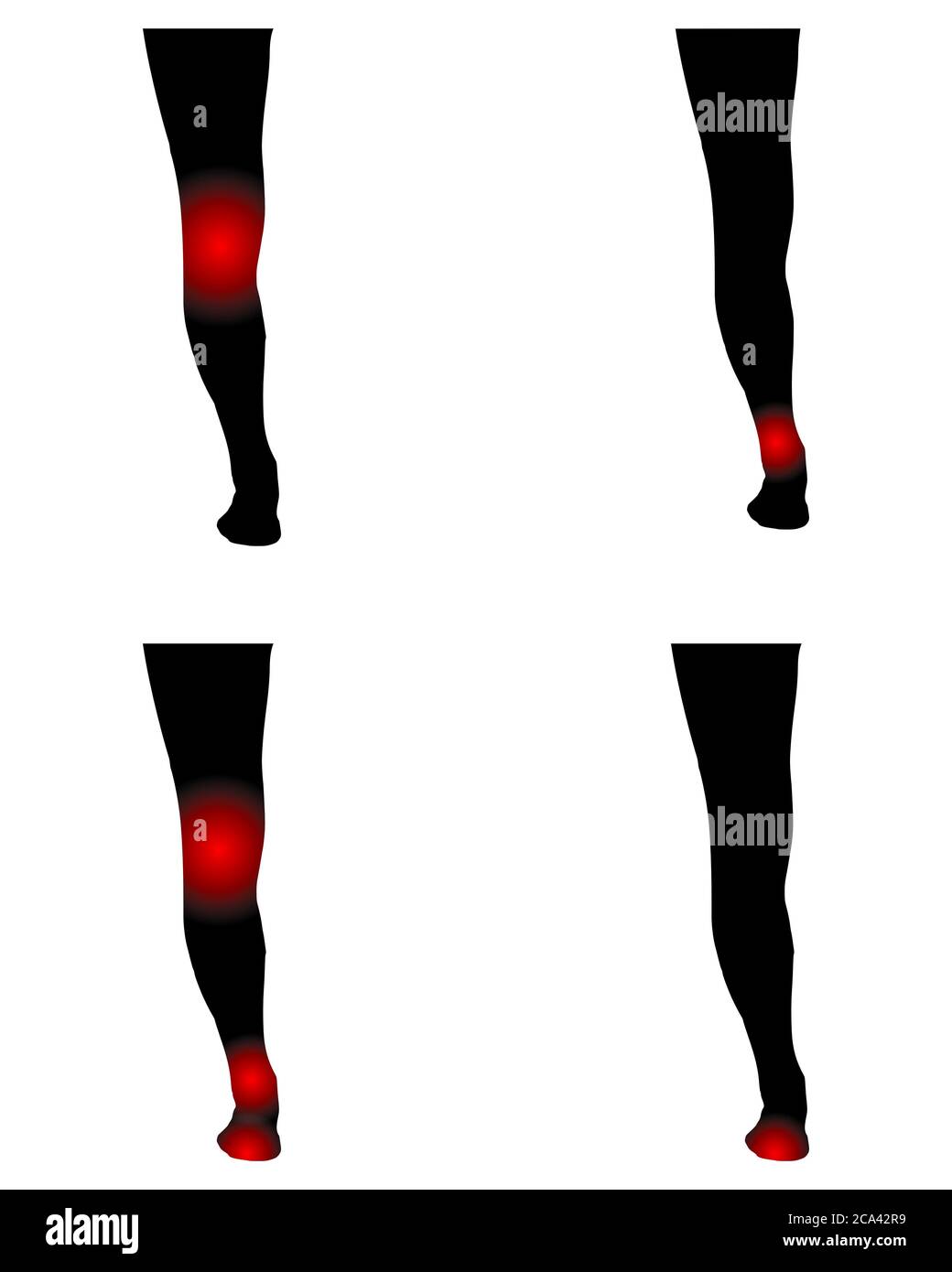 Human legs with pain points Stock Photo - Alamy