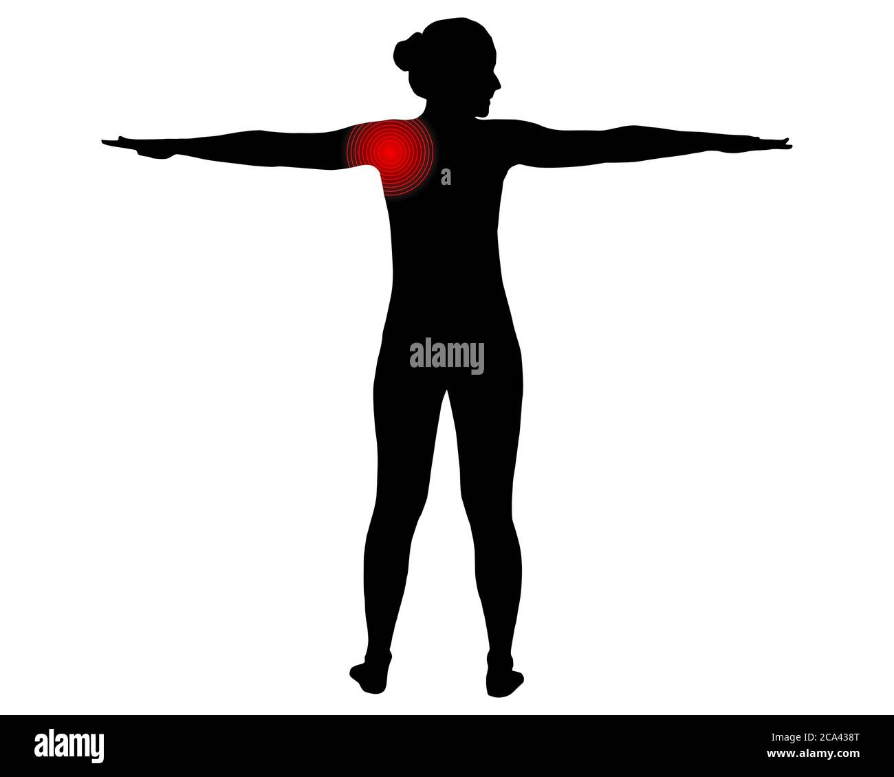 Back view of woman with with symbol for shoulder pain Stock Photo - Alamy