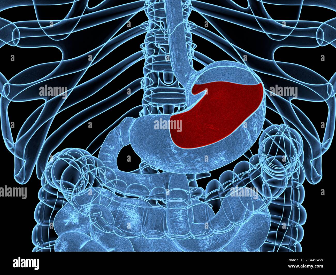 Acid reflux, GERD. Gastroesophageal reflux disease. Stomach and ...