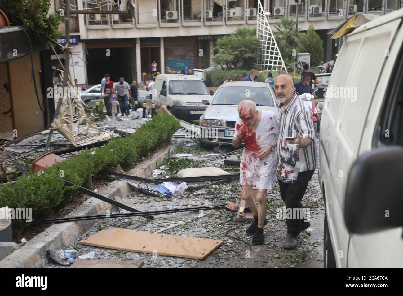 Beirut, Lebanon. 4th Aug, 2020. An injured person is seen after the ...