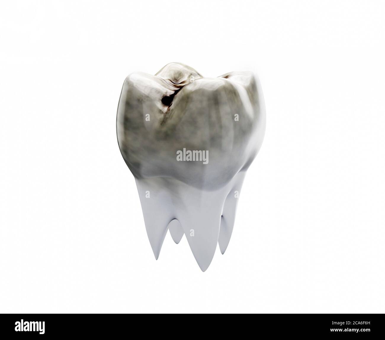 Decay protection Cut Out Stock Images & Pictures - Alamy