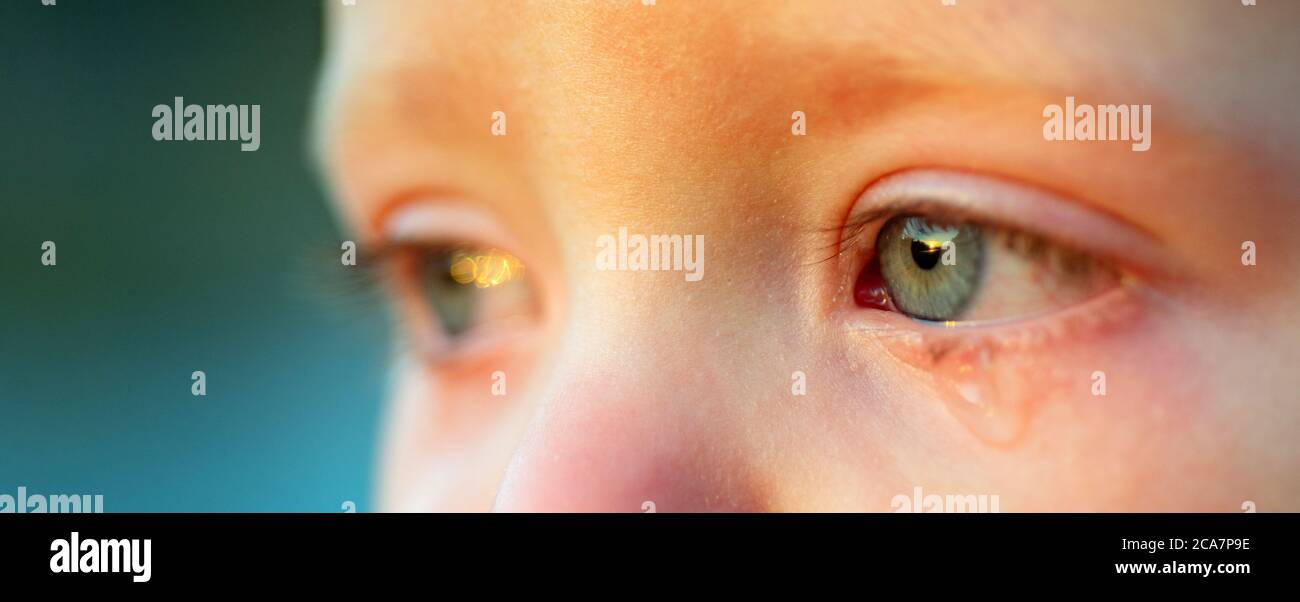 Cry baby with sky blue eyes, close up. Little tender boy crying. Eye ...