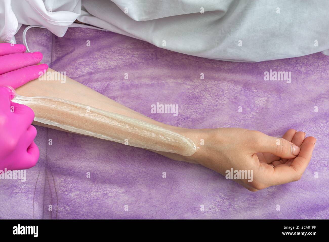 Removing unnecessary hair on the arms. Procedure sugaring in a beauty ...