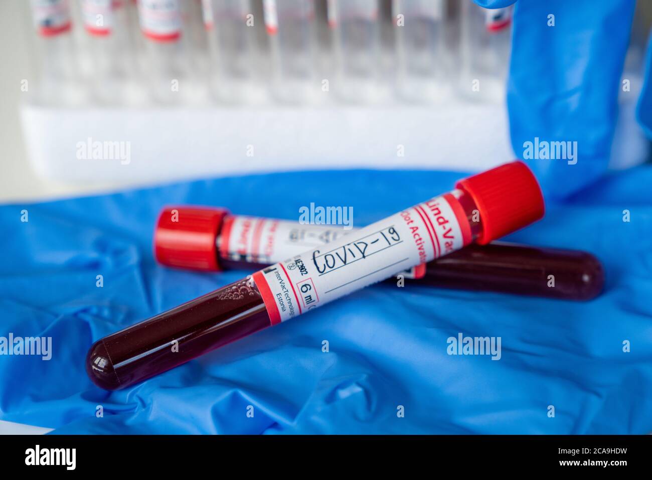 Soft focus of vials with blood sample to test for COVID-19 infection ...