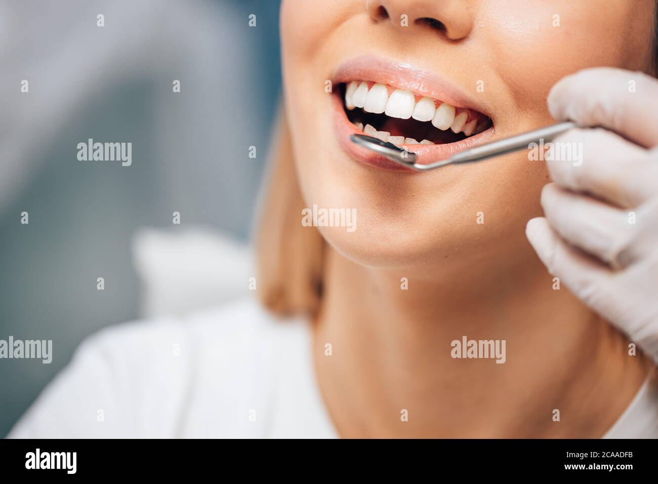 Orthodontic examination of teeth, young woman patient examine teeth ...
