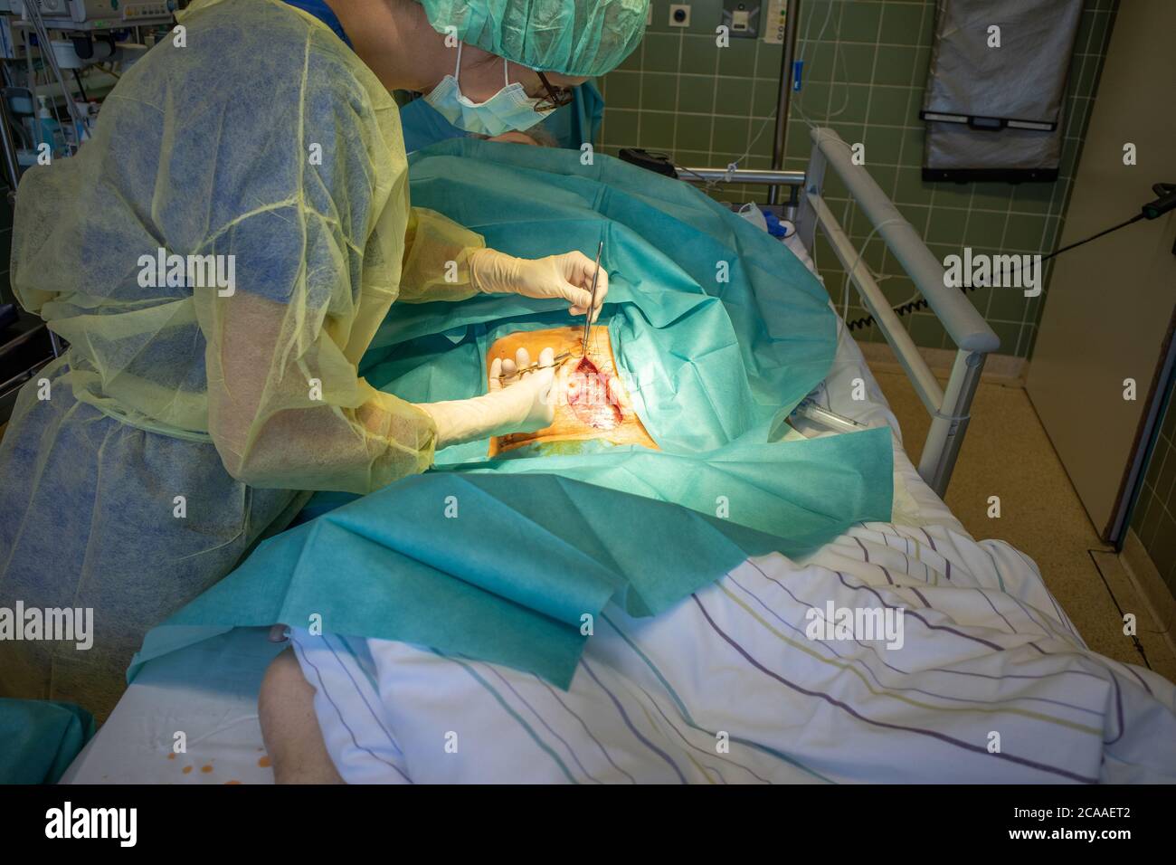 Surgical Sutures High Resolution Stock Photography and Images - Alamy