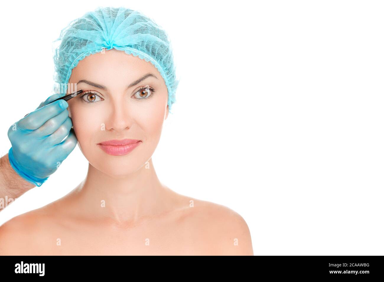 Double upper Eyelid Surgery, Eyes Surgery stitches removed by doctor ...