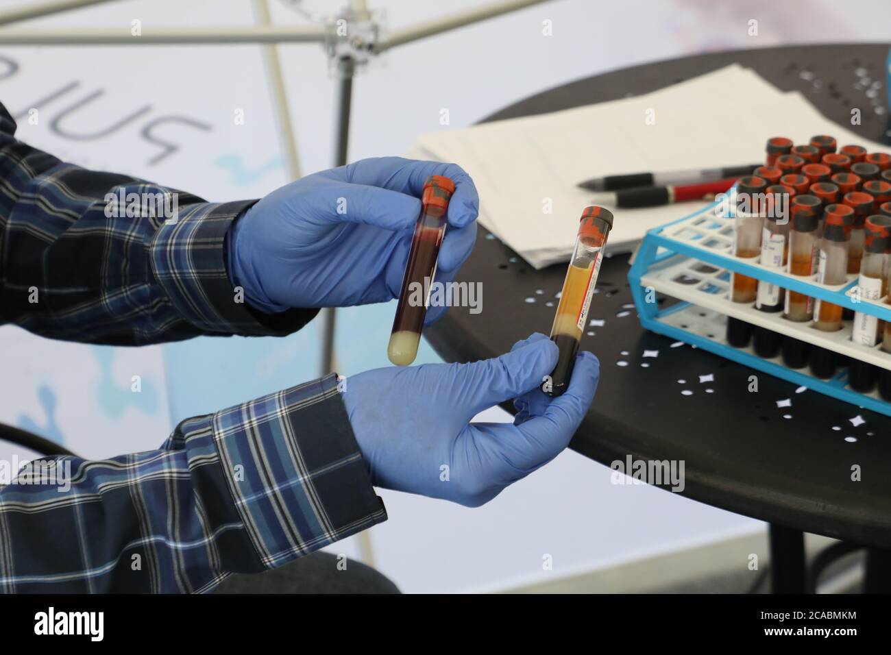 Separated blood sample hi-res stock photography and images - Alamy