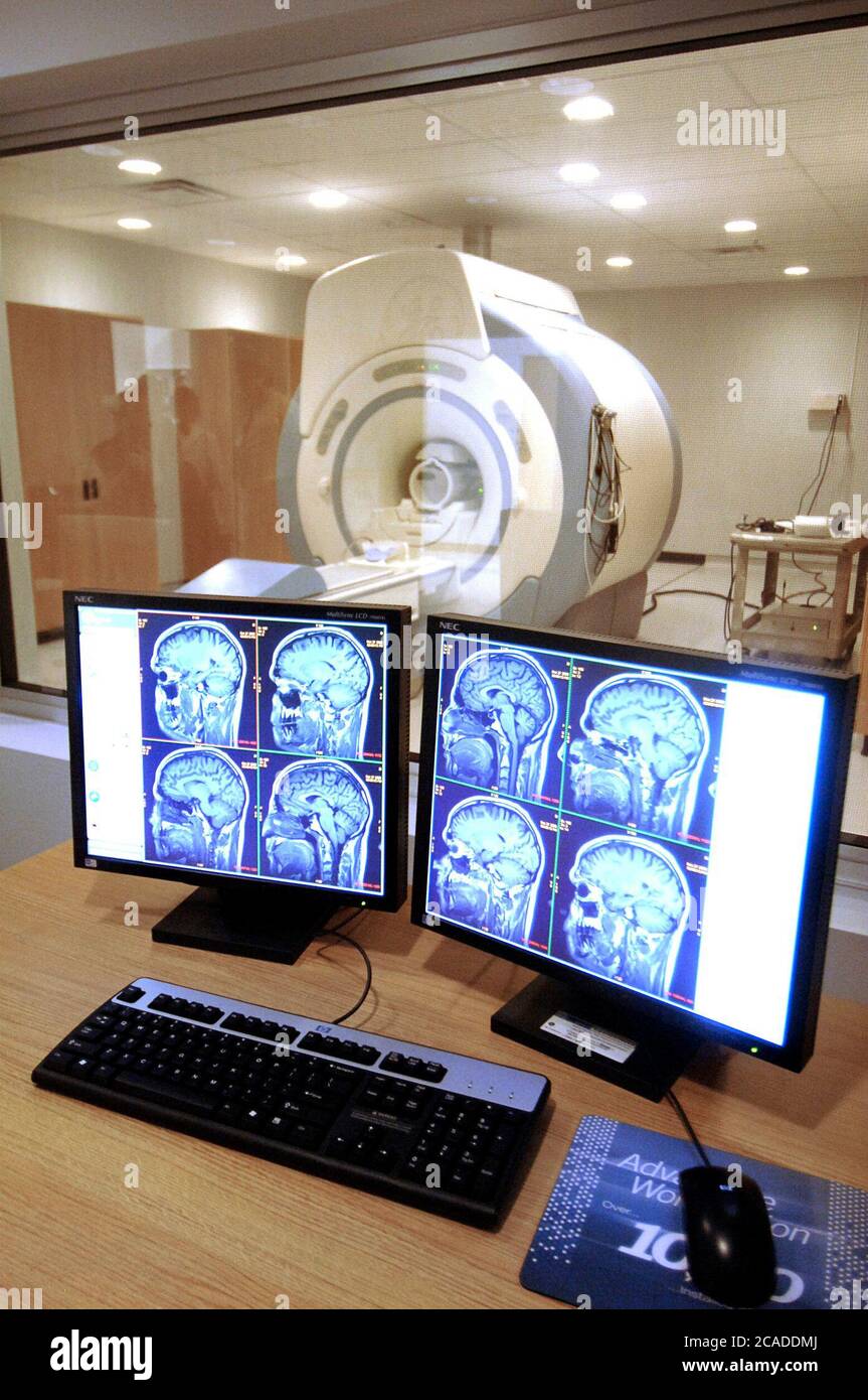 Brain function mri hi-res stock photography and images - Alamy