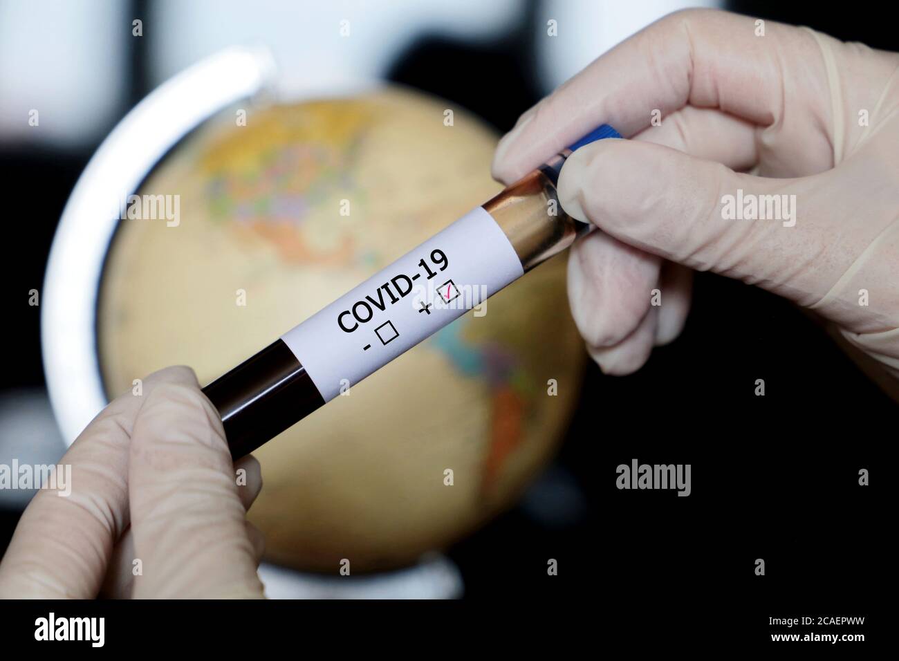 Test tube with covid-19 blood sample in female hands on globe ...