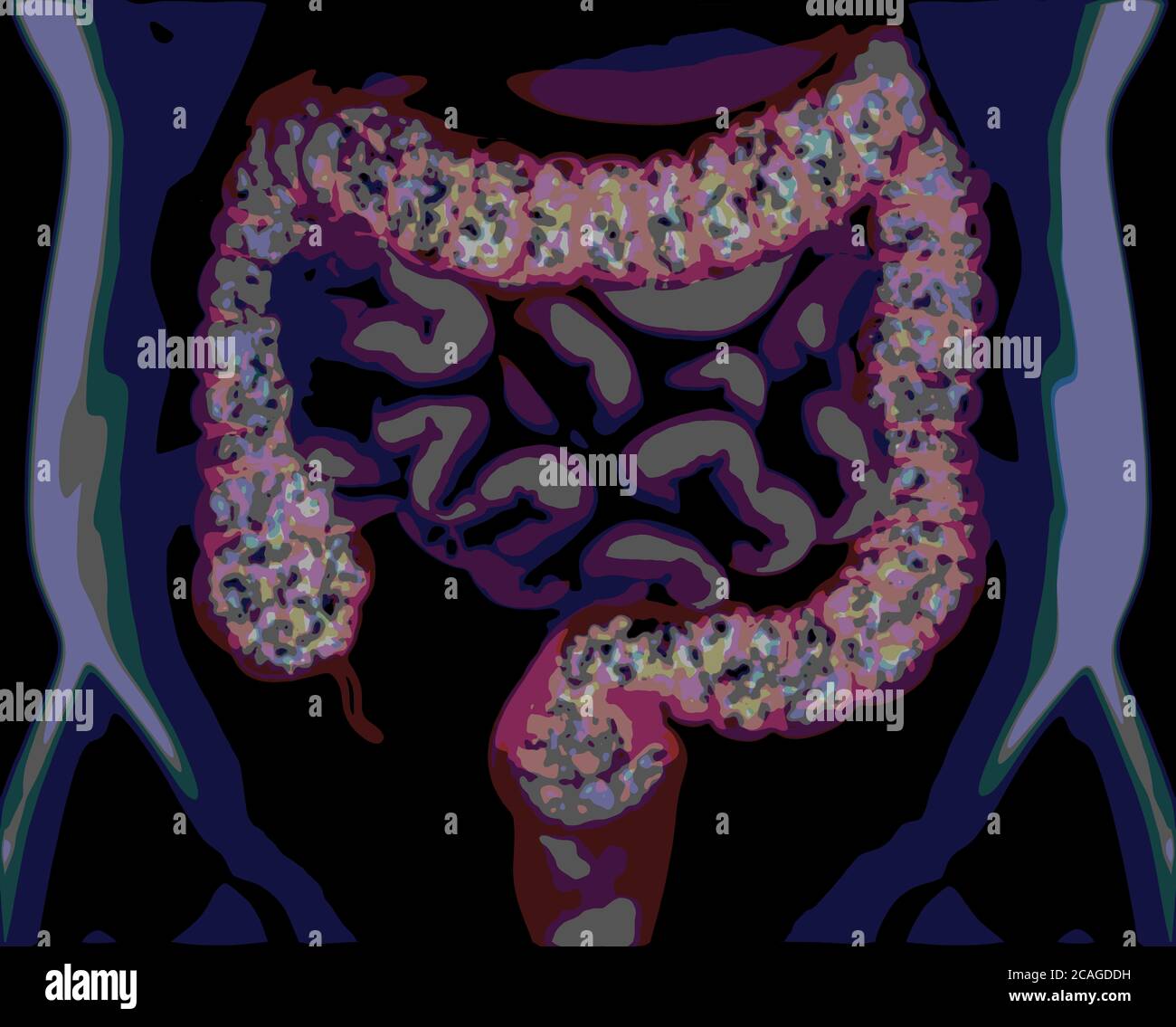 Gut bacteria, microbiome. Bacteria inside the large intestine, concept ...