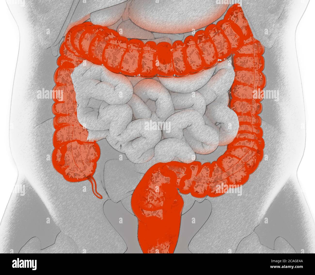 Gut bacteria , gut flora, microbiome. Bacteria inside the small ...