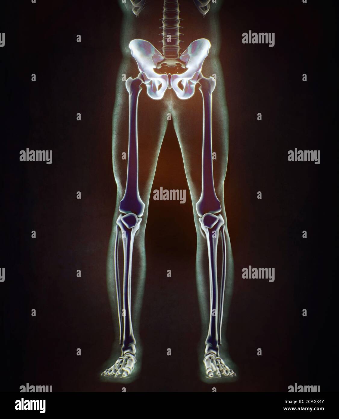 Illium Bone Hip Bone Or Pelvis Human Anatomy Bone Skeletal Structure Xray 3d Illustration
