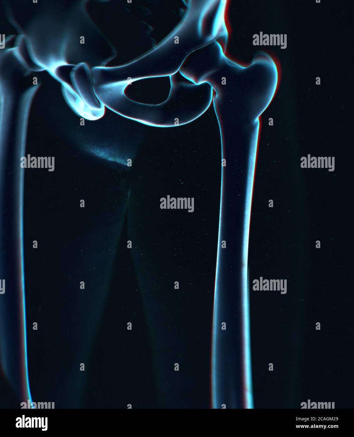 Ilium bone, hip bone or pelvis. Human anatomy, bone skeletal structure ...