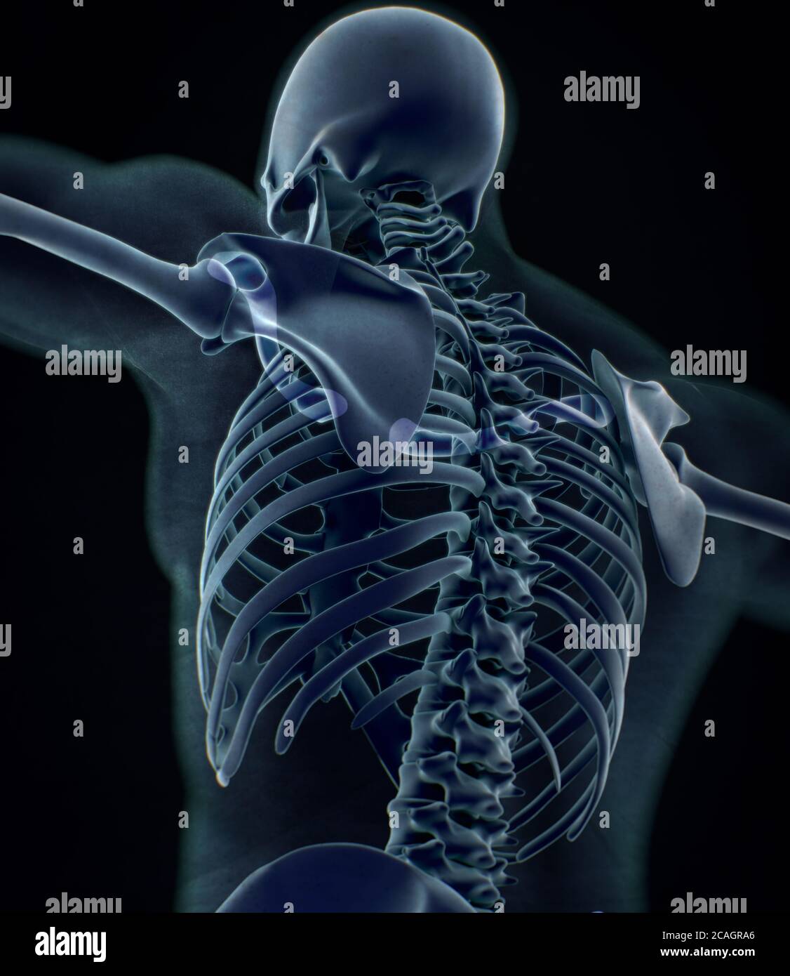 Collarbone X Ray High Resolution Stock Photography and Images - Alamy
