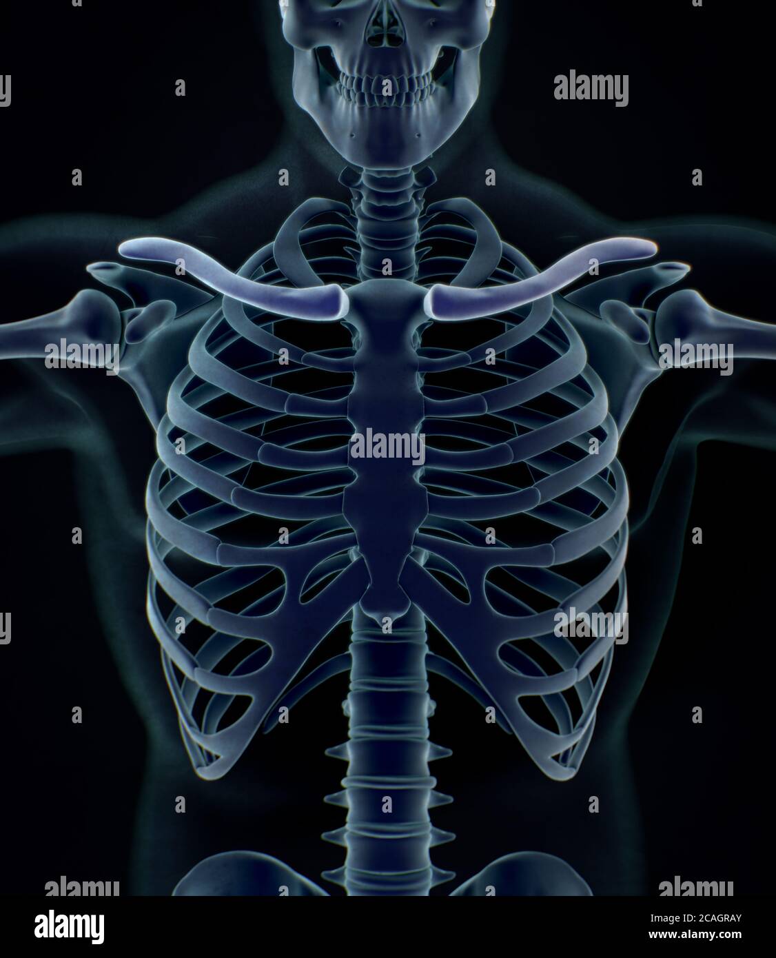 Collarbone X Ray High Resolution Stock Photography and Images - Alamy