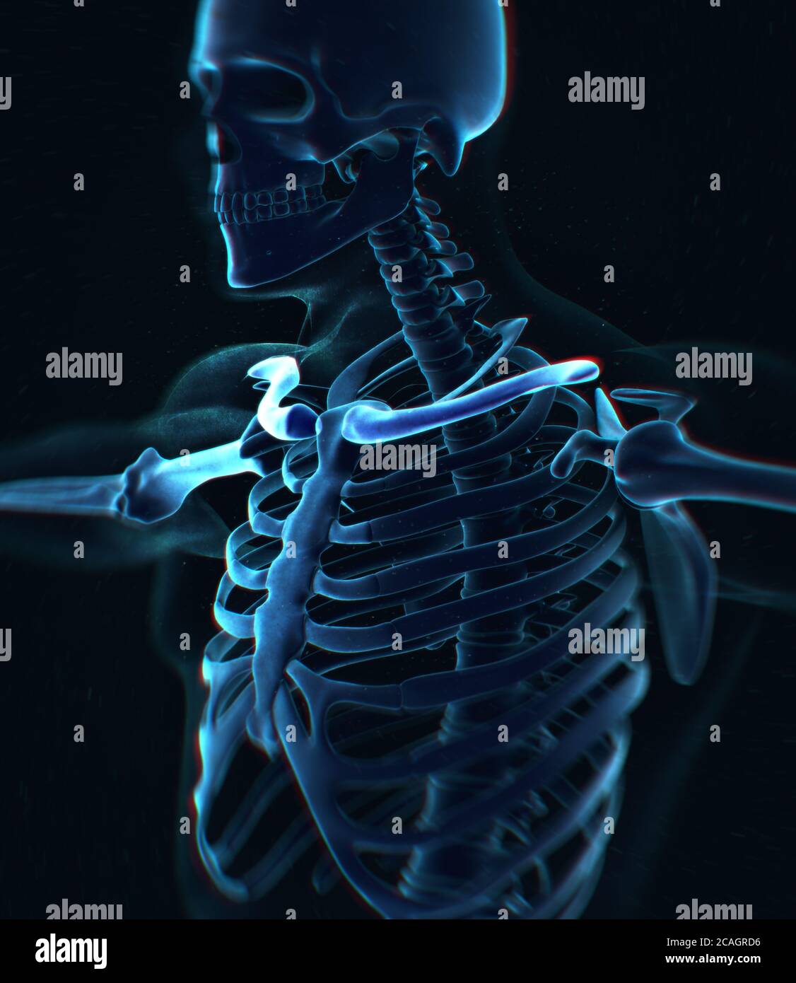Collarbone X Ray High Resolution Stock Photography and Images - Alamy