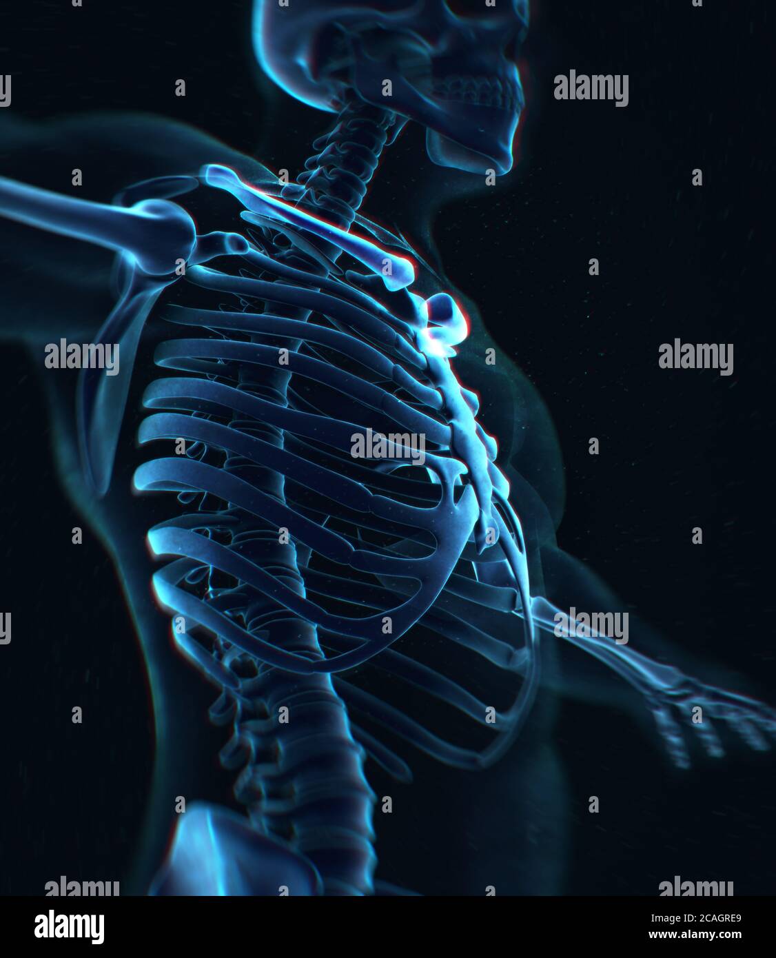 Collarbone x ray hi-res stock photography and images - Alamy