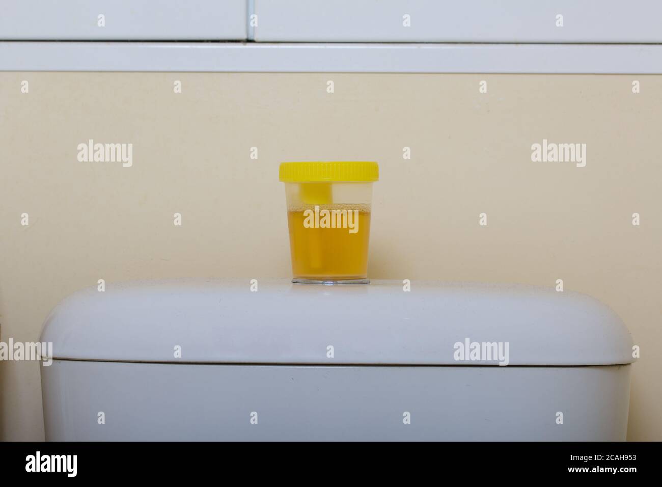 Urine in a container for analysis. Stands on the toilet cistern ...
