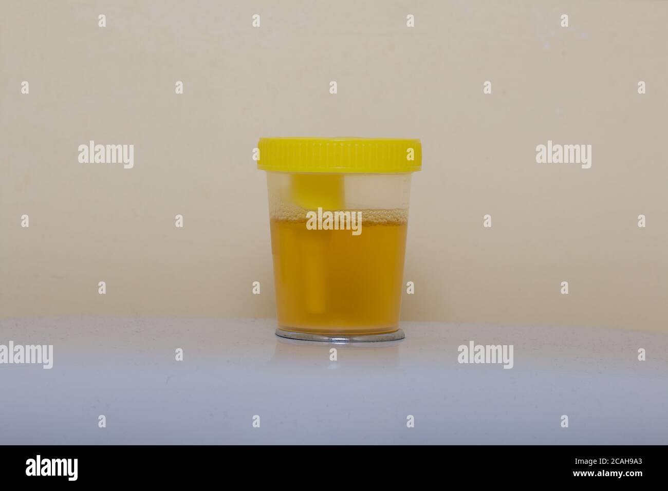 Urine in a container for analysis. Stands on the toilet cistern ...