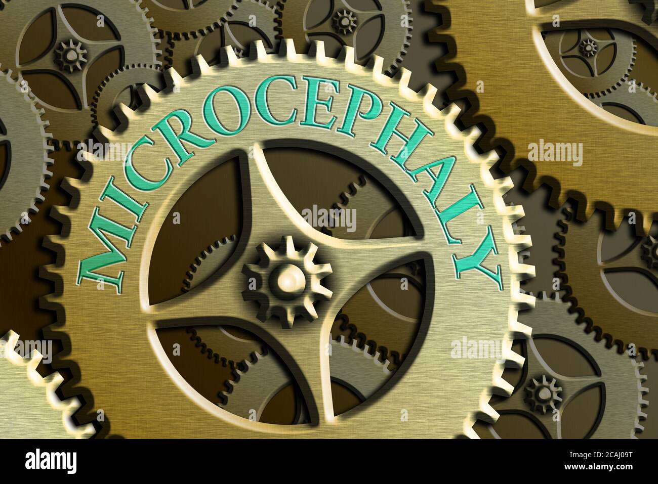 Writing note showing Microcephaly. Business concept for condition of ...