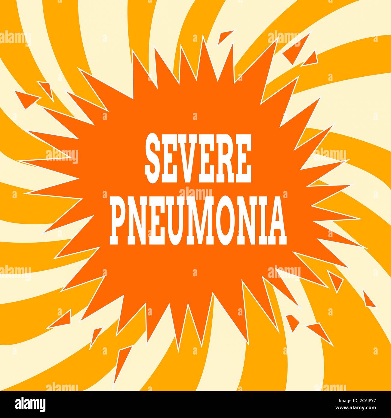 Text sign showing Severe Pneumonia. Business photo text acute disease ...