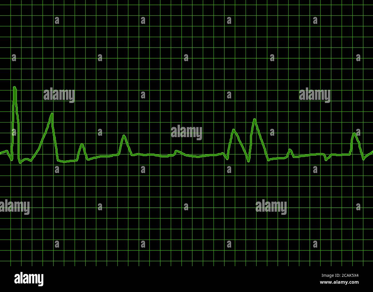 Illustration of the charts going up and down Stock Photo - Alamy