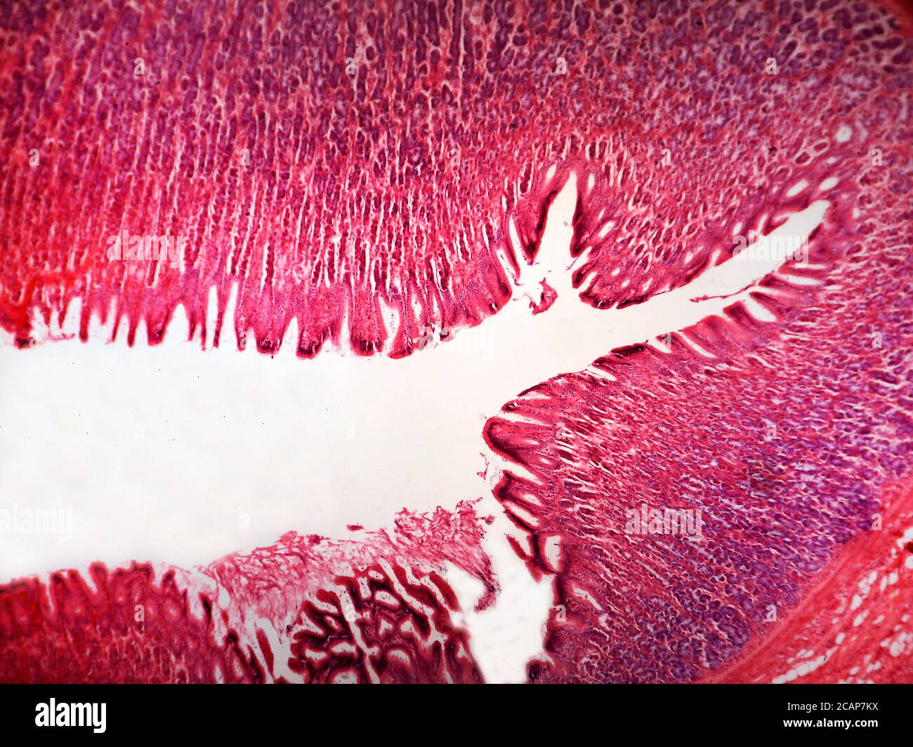 Microphotography of gastric folds Stock Photo - Alamy