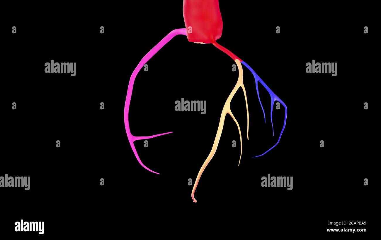 Colorful of CTA Coronary artery 3D rendering image or coronary tree 3d ...