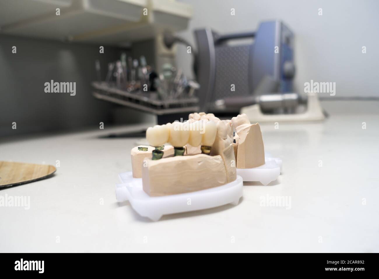 zirconia dental crowns on dental models in the dental laboratory Stock ...