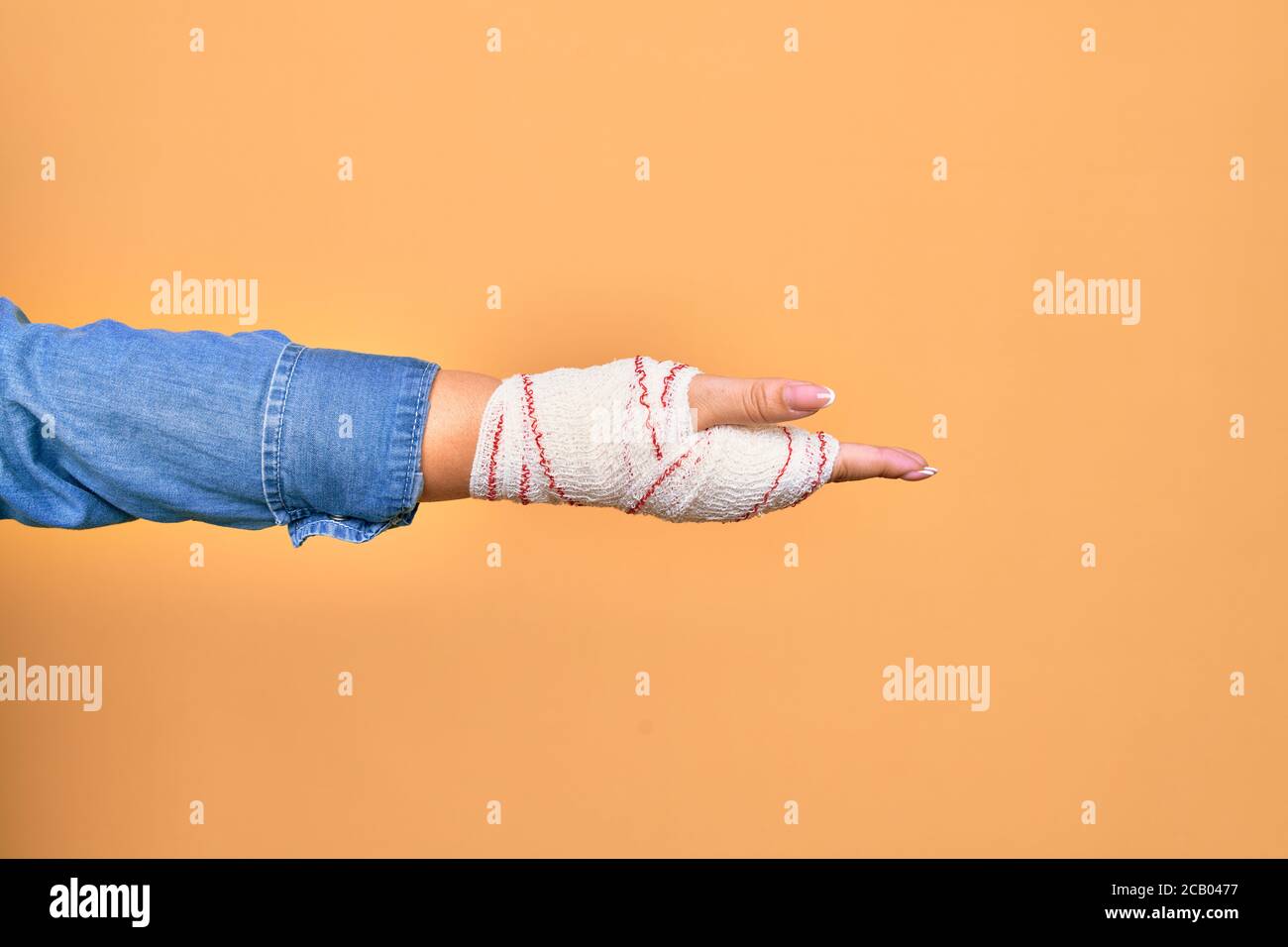 Wounded hand of caucasian young woman cover with bandage doing give me ...